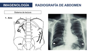RX TÓRAX Y ABDOMEN, CLASE DE IMAGENEOLOGIA | PPTX