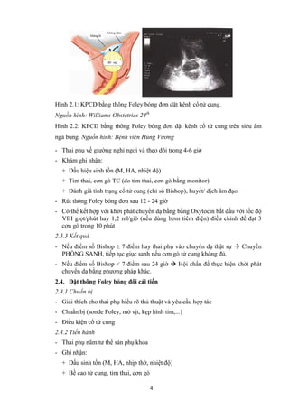 khởi phát chuyển dạ | PDF