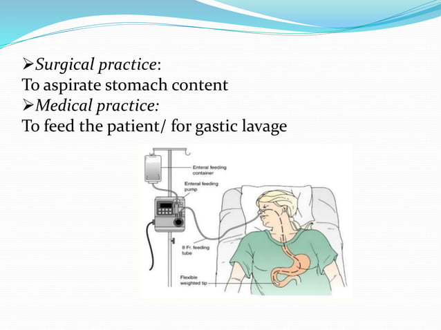 Ryles tube insertion | PPTX