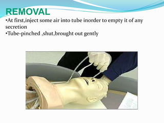 Ryles tube insertion | PPTX