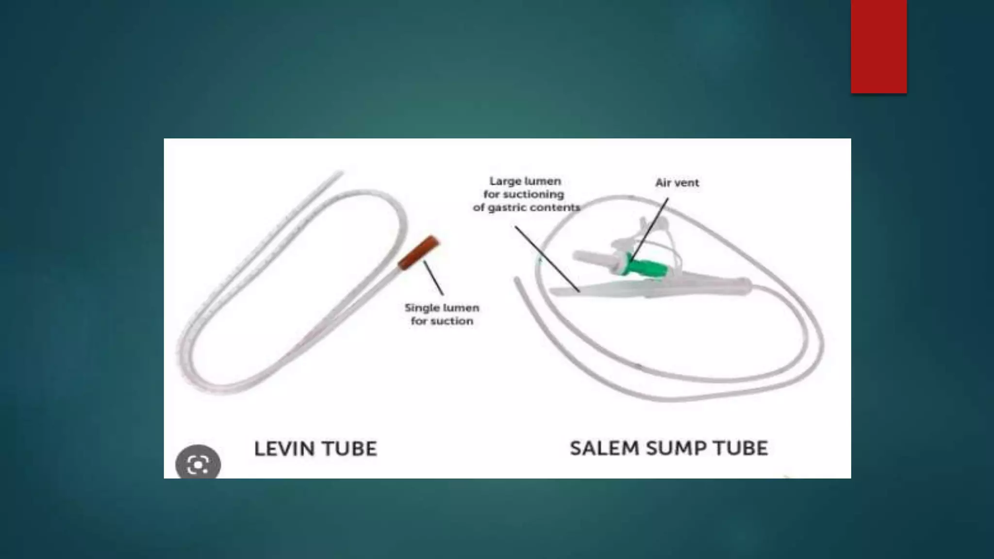 Ryles Tube Insertion And Feeding.pptx