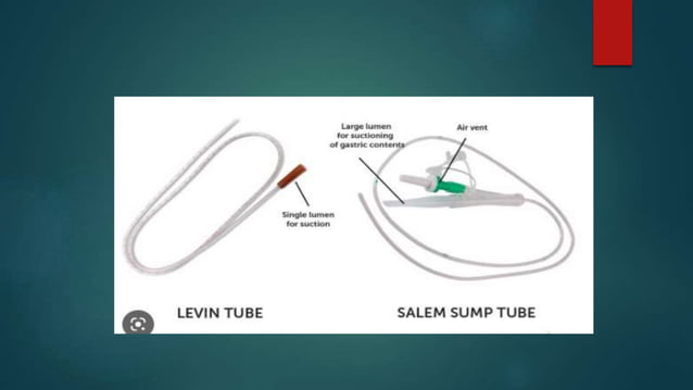 Ryles Tube Insertion And Feeding.pptx