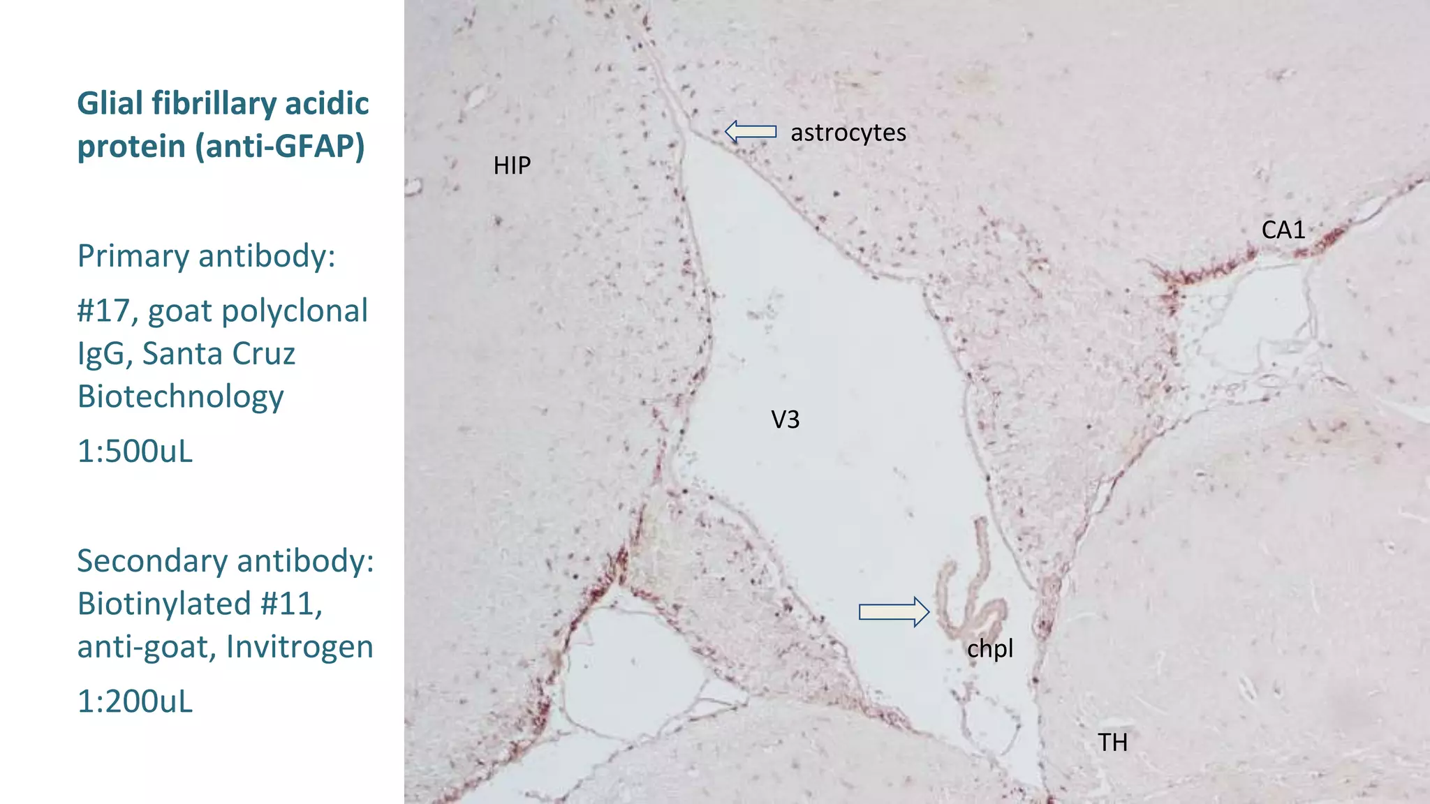 Mouse brain immunohistochemistry staining | PPT