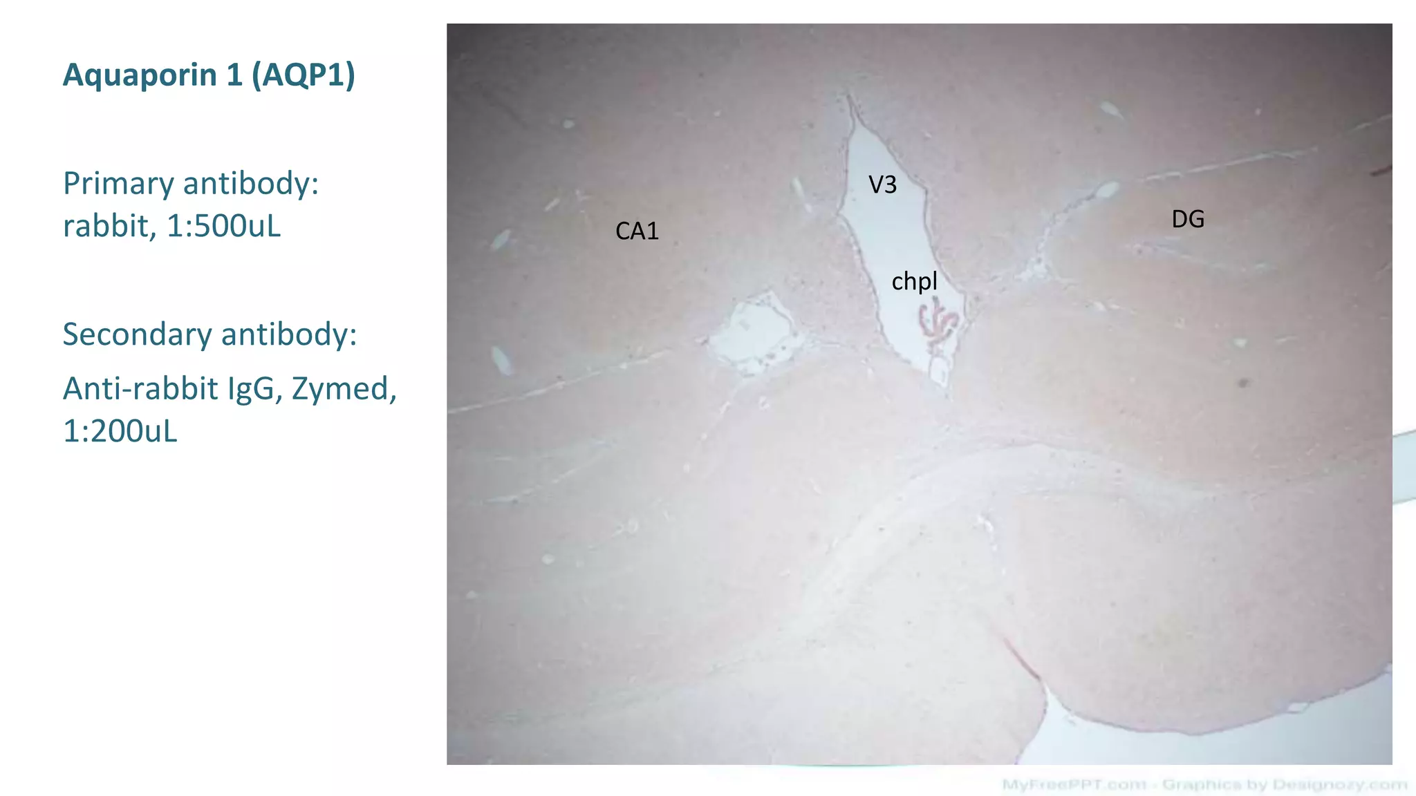 Mouse brain immunohistochemistry staining | PPT