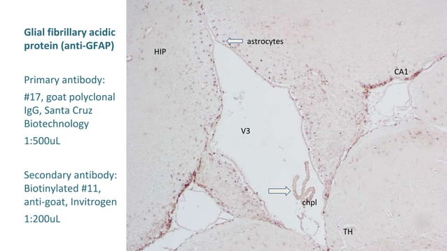Mouse brain immunohistochemistry staining | PPT