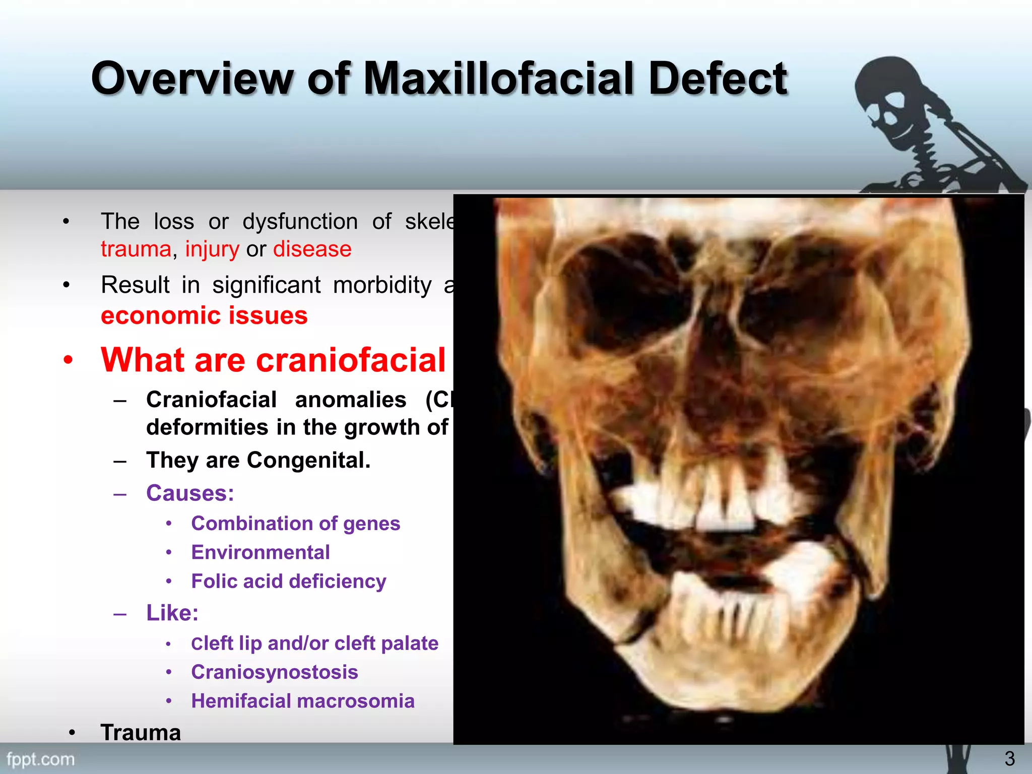 Bone tissue engineering challenges in oral and maxillofacial surgery | PPTX