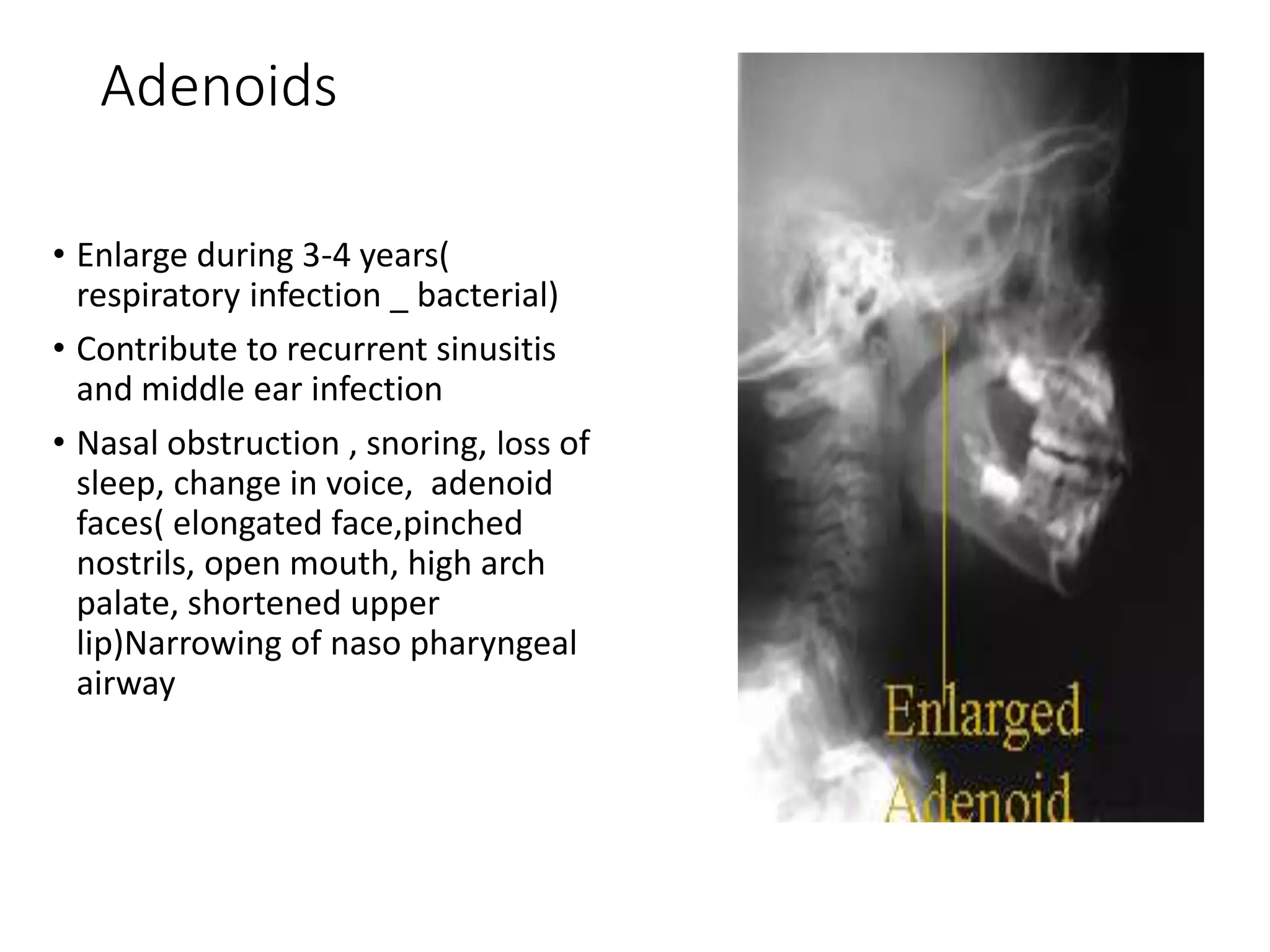Surgical Anatomy of Lymph nodes | PPTX