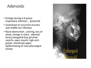 Surgical Anatomy of Lymph nodes | PPTX