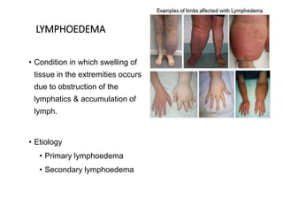Surgical Anatomy of Lymph nodes | PPTX