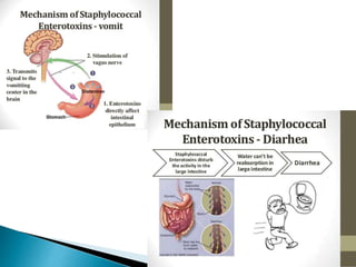 Staphylococcus aureus | PPTX