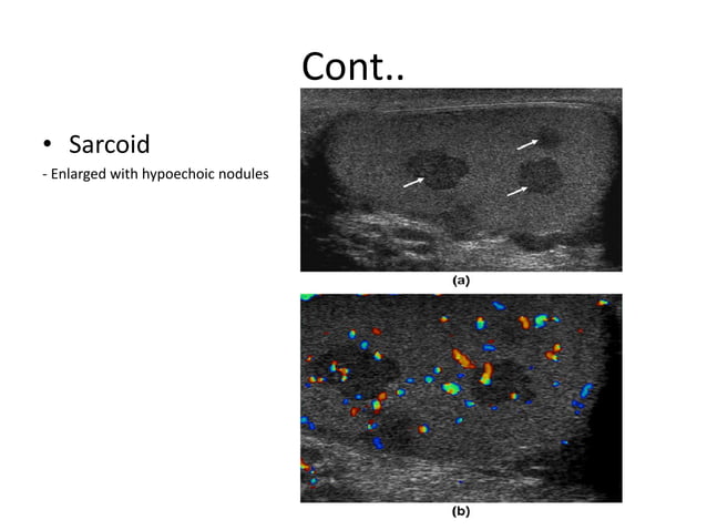 imaging of scrotal diseases | PPTX | Infertility | Reproductive Health