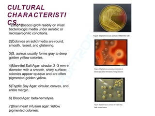 Staphylococcus aureus - Jahnvi arora (11228108) , mmdu, mullana .pptx
