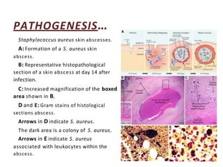 Staphylococcus aureus - Jahnvi arora (11228108) , mmdu, mullana .pptx