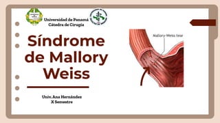 Síndrome de Mallory Weiss | PDF