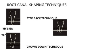 Step back and crown down technique in root canal treatment | PPTX