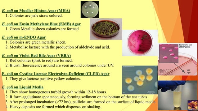 E. coli (Morphology, Growth Requirements and Genetics) | PPT