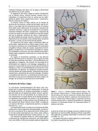 Hallux Valgus | PDF
