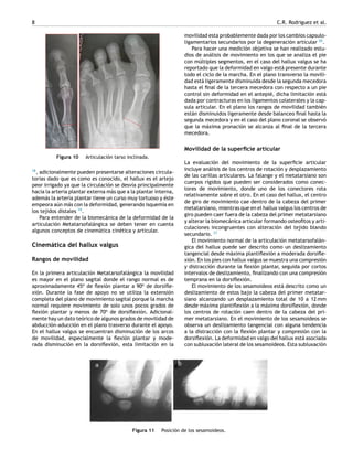 Hallux Valgus | PDF