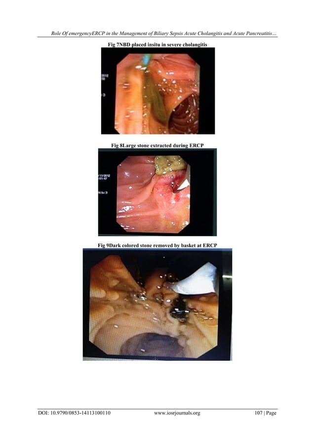 Role Of Emergency ERCP in the Management of Biliary Sepsis Acute ...