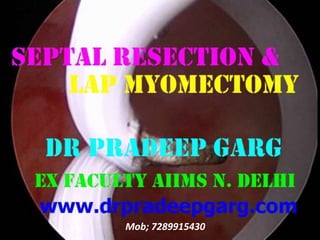 Septal Resection & Lap Myomectomy : Dr Pradeep Garg | PPTX