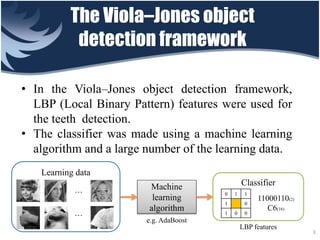 歯の自動検出法の検討 | PDF