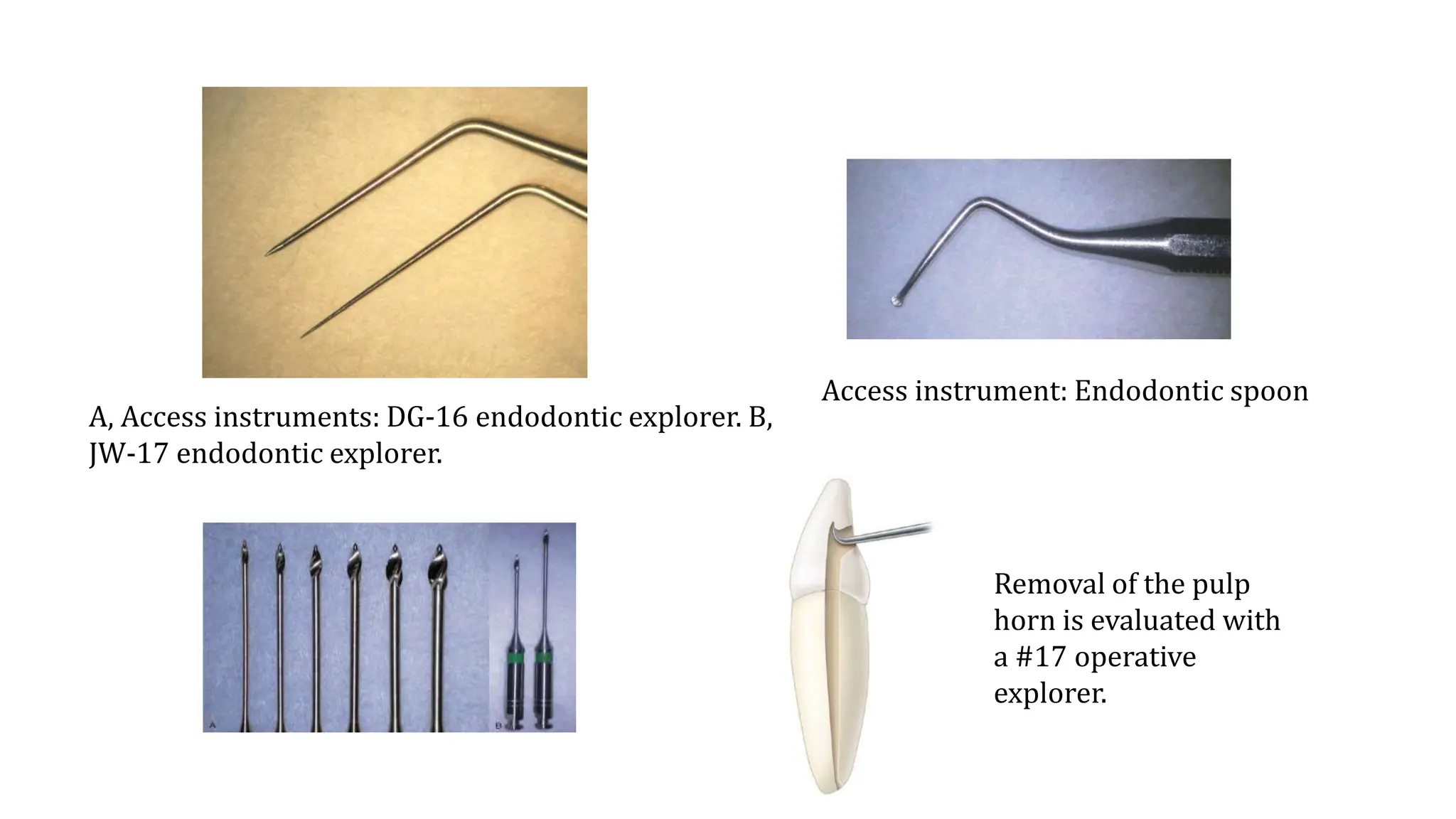 S11 endodontic ACCESS_CAVITY_PREPARATION.pptx