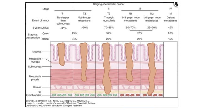 S11 Approach to Colorectal Carcinoma.pdf