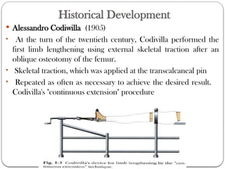 distraction osteogenesis in orthodontics | PPTX