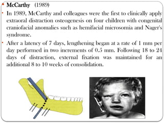 distraction osteogenesis in orthodontics | PPTX