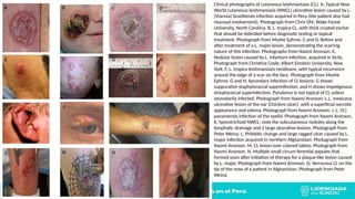 S12_Casos-clinicos-de-VIH, Dengue, Leishmaniasis, Sífilis.pptx