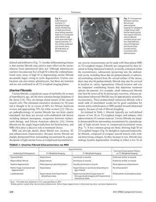 MRI of Benign Female Pelvis | PDF