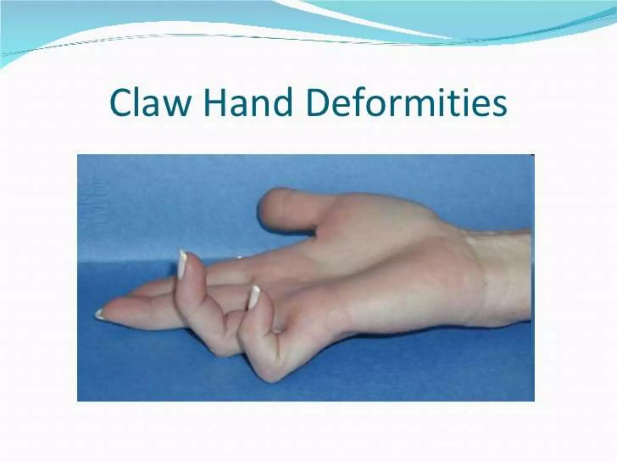 Peripheral nerve of the upper limb | PPTX