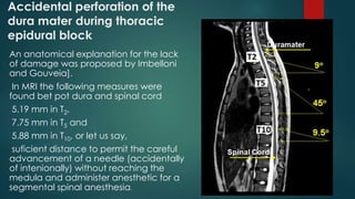 Change_in_Anesthesia_practices_-_Covid_times.pptx