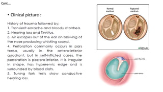 S1 Trauma to the ear.pptx