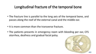 S1 Trauma to the ear.pptx