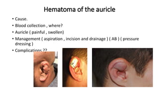 S1 Trauma to the ear.pptx