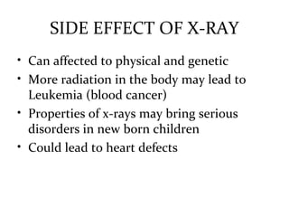 X -RADIATION or RONTGEN RADIATION (X-RAY) | PPT
