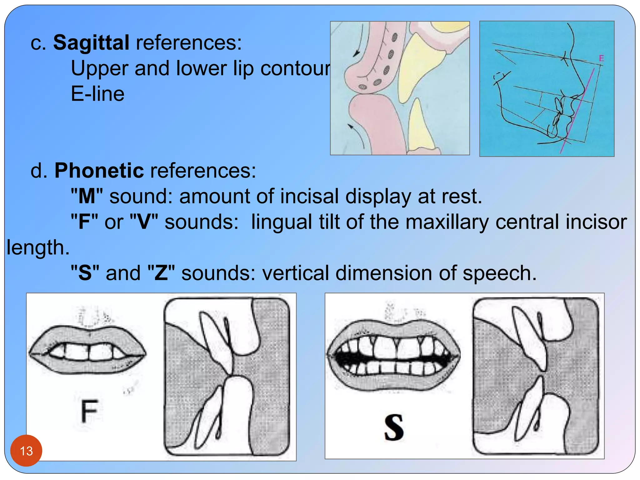 Esthetics in FPD | PPTX