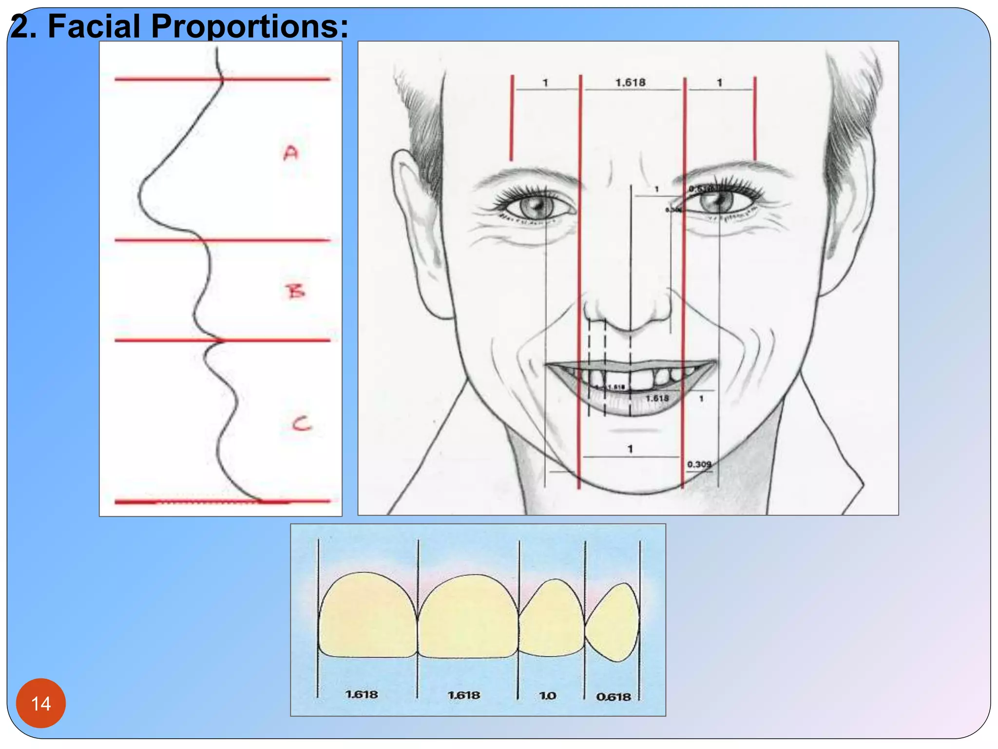 Esthetics in FPD | PPTX