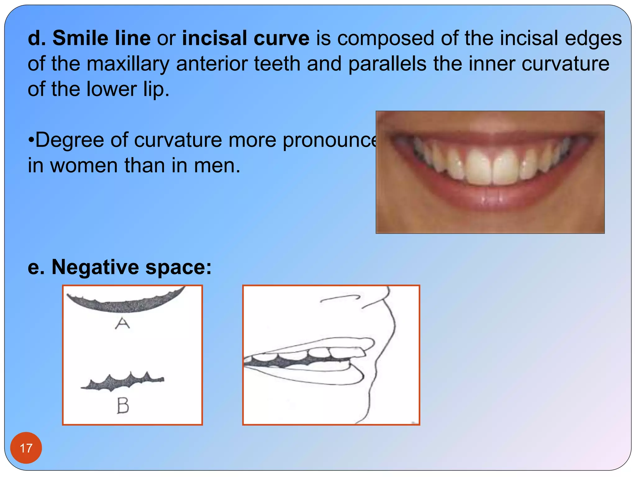 Esthetics in FPD | PPTX