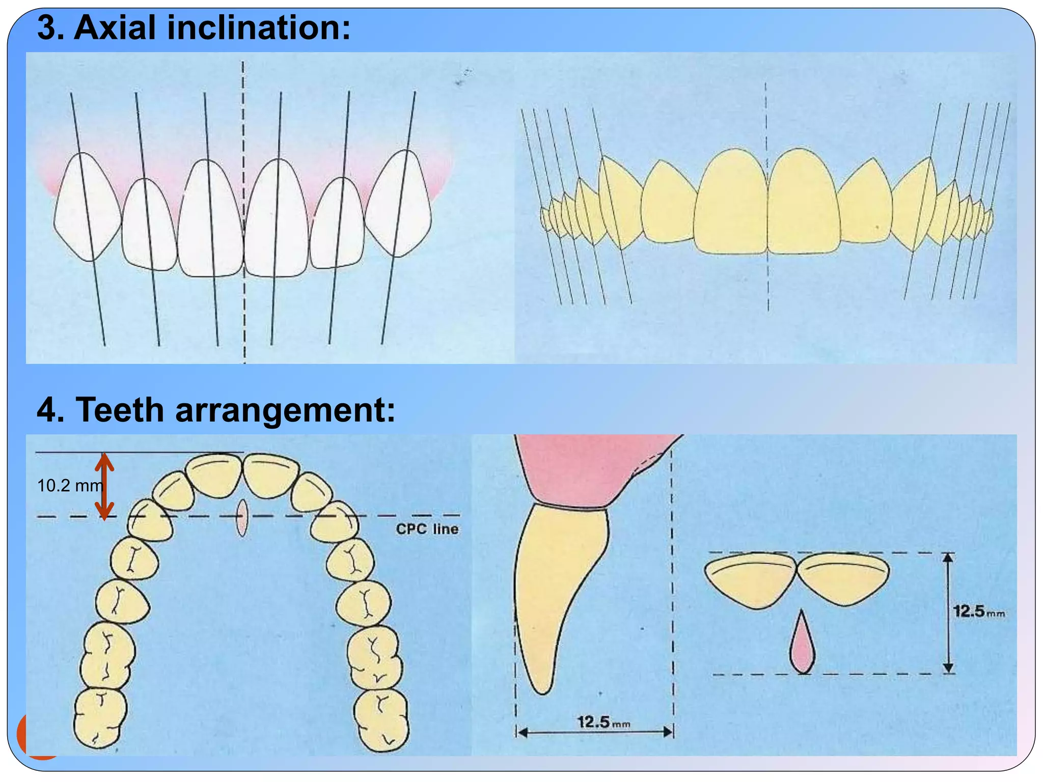 Esthetics in FPD | PPTX
