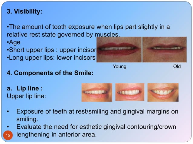 Esthetics in FPD | PPTX | Dental Health | Diseases and Conditions