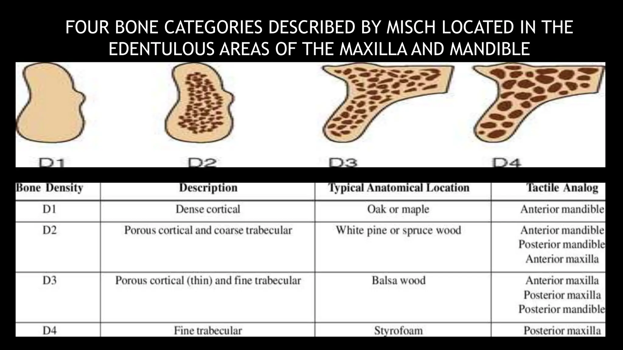 PHYSIOLOGY OF BONE AND ITS PROSTHODONTIC IMPLICATIONS | PPTX
