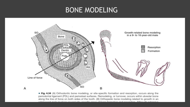 PHYSIOLOGY OF BONE AND ITS PROSTHODONTIC IMPLICATIONS | PPTX | Bone and ...