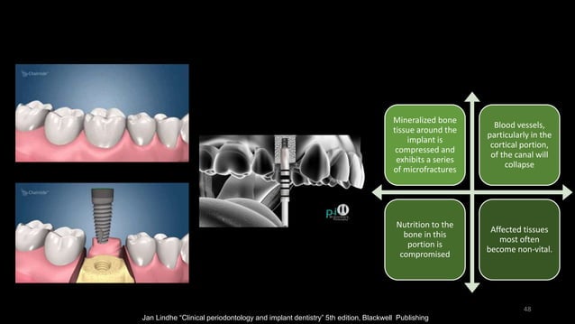 PHYSIOLOGY OF BONE AND ITS PROSTHODONTIC IMPLICATIONS | PPTX | Bone and ...