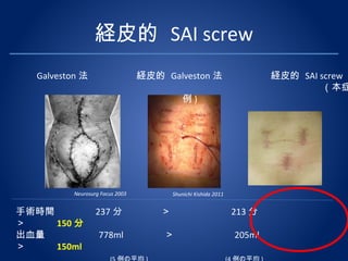 【地方会】S2AI screw による腰椎骨盤固定術 | PPT