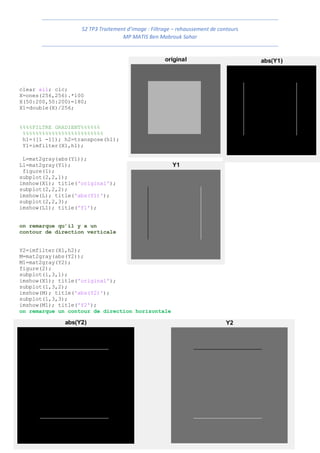 S2 TP3: traitement d'image: filtrage rehaussement de contour | PDF