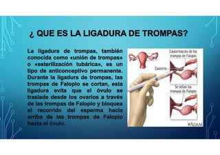 S3- MÉTODOS ANTICONCEPTIVOS DEFINITIVOS- LIGADURA DE TROMPAS.pdf