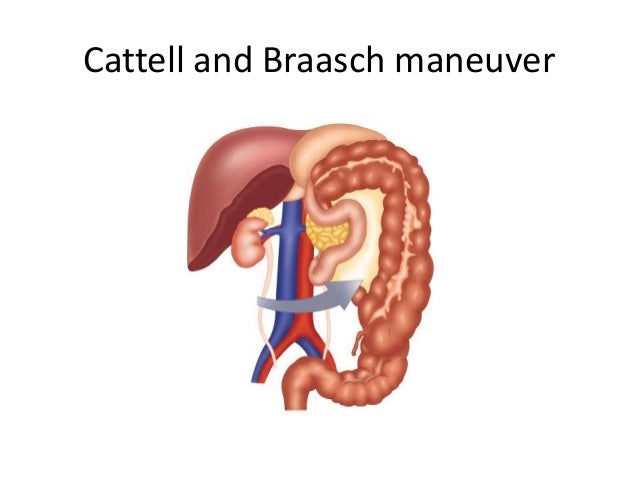 Duodenal injuries