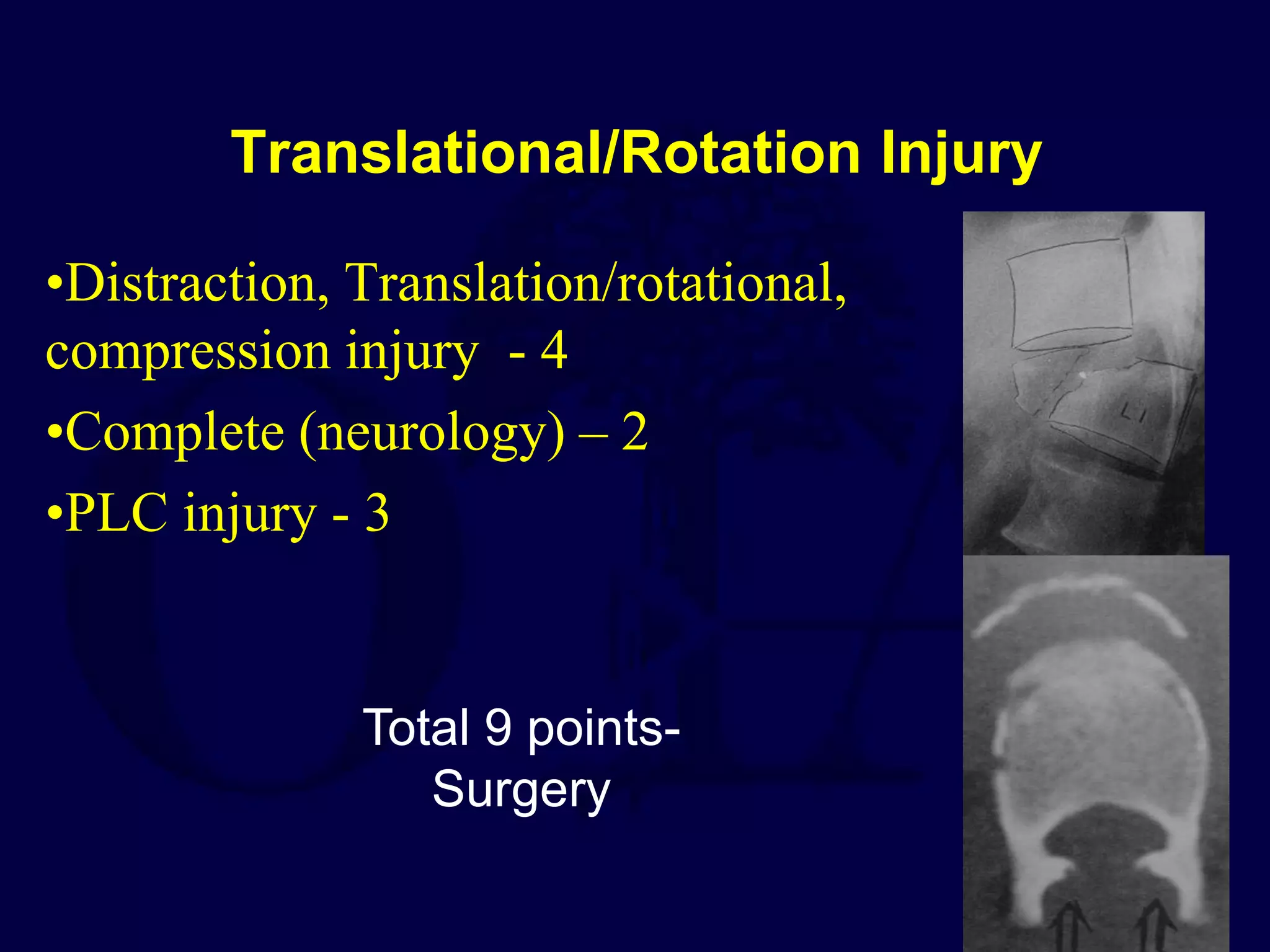 S4_Classification-Thoracolumar-Spine.ppt